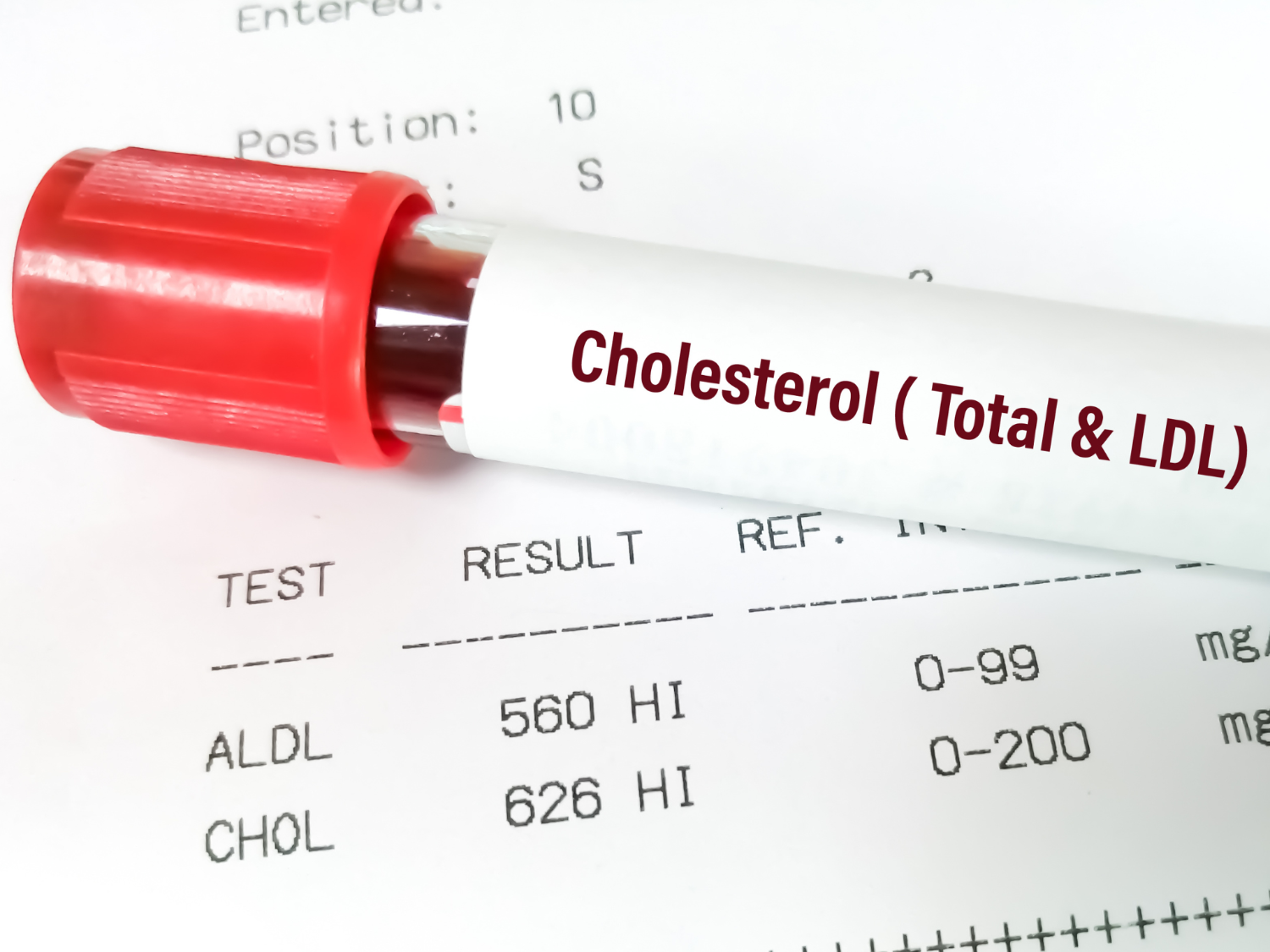 Cholesterol Awareness Month: Is It Time for a Checkup? - Marque Urgent Care